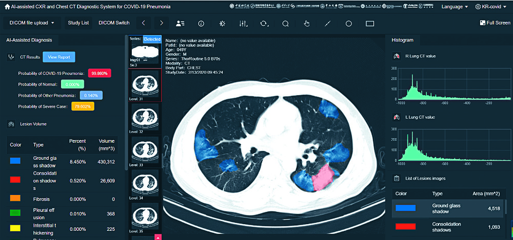 20-second test in virus picture