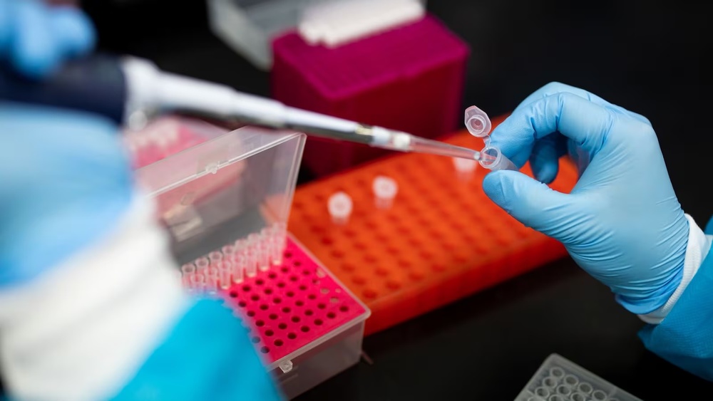 Chinese Hospital Sees Cell Therapy Promise In Big Lupus Trial