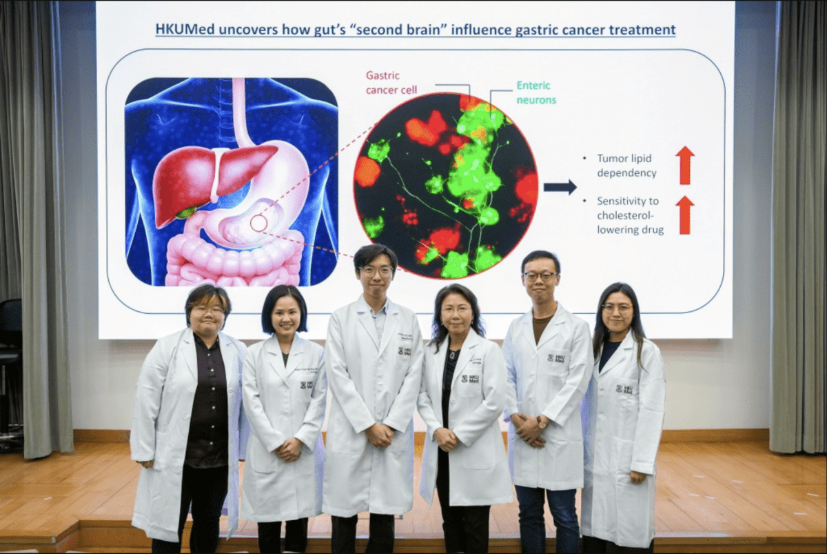 HKUMed research team discovers gut neurons are key accomplice in ...