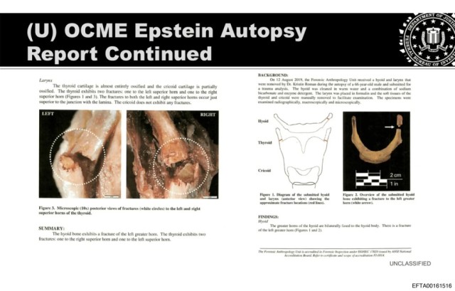 First photos of Epstein after jail suicide released, autopsy details ...